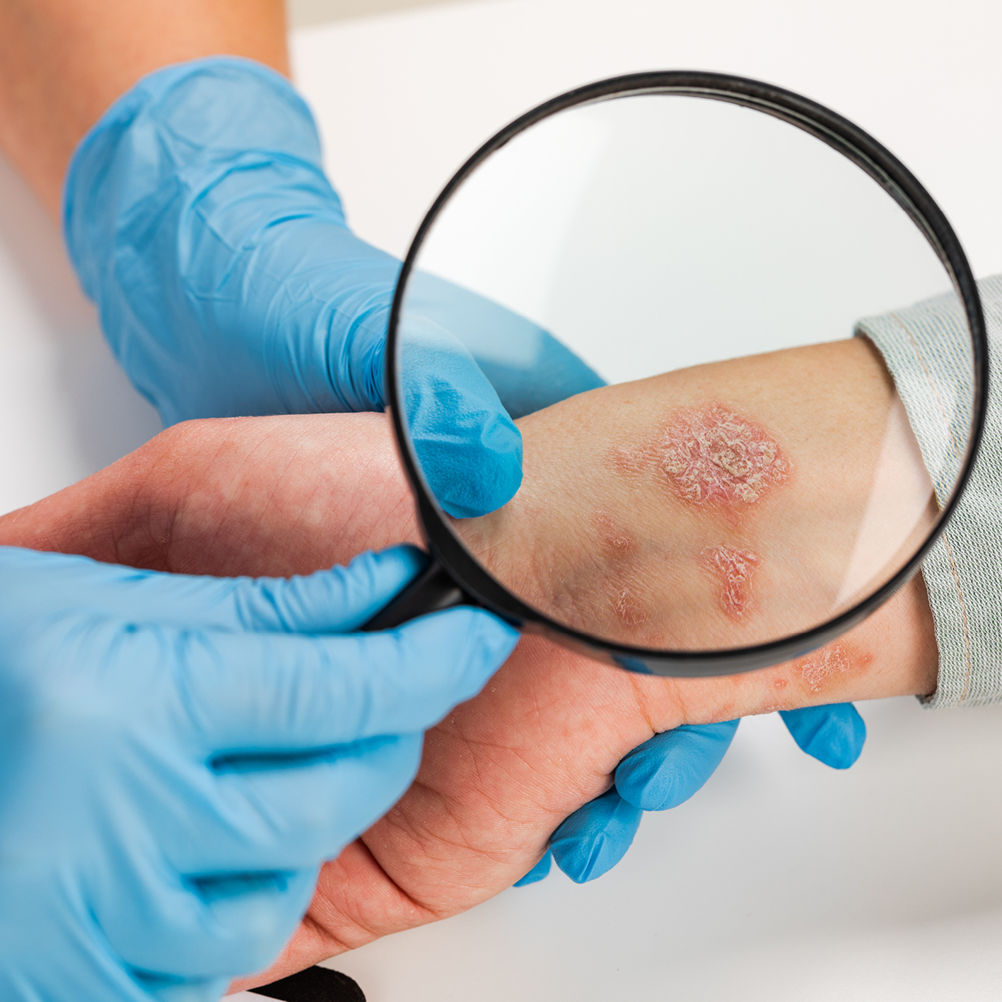 Medical Dermatology - Med Gray by Med Cell